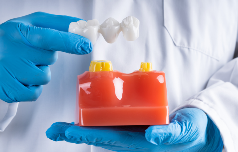 Ile kosztuje aparat na zęby? - DentalCare32